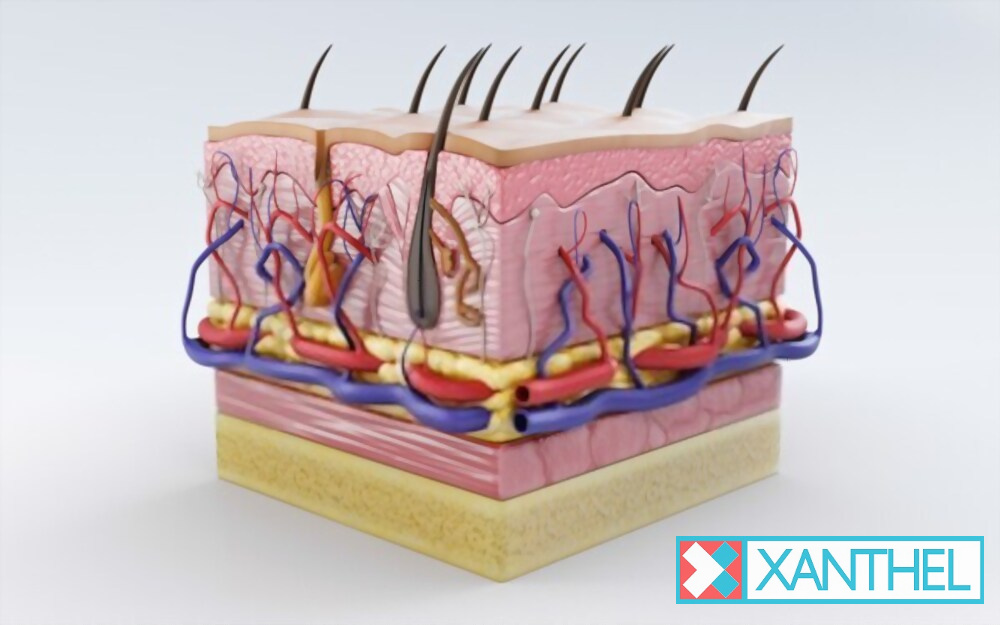 What Are Cholesterol Spots - Xanthel